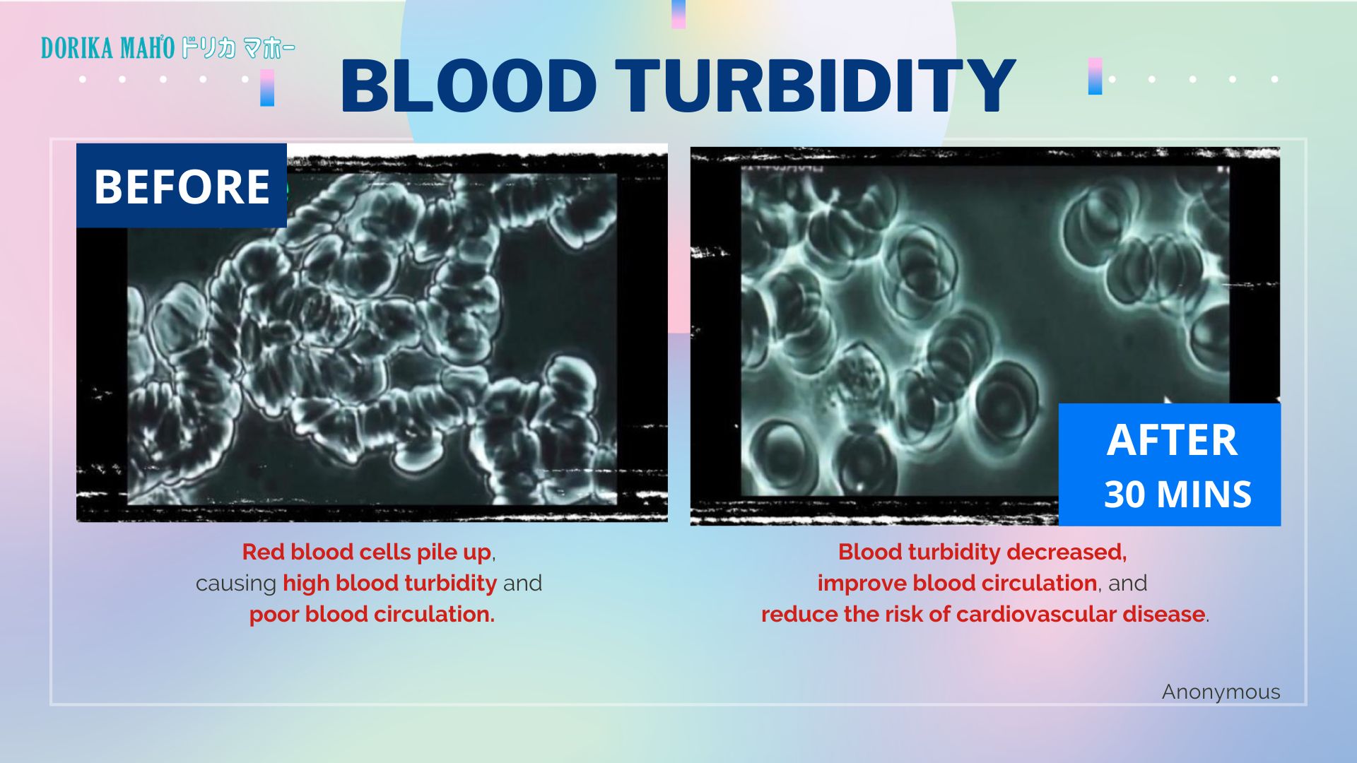 Improve Blood Circulation: a 30-Minute Transformation - DORIKA MAHO